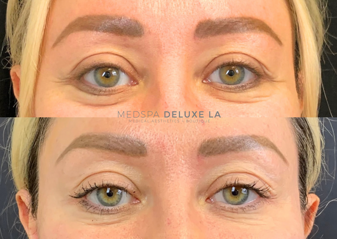 SPECIALS + MORE – MEDSPA DELUXE LA